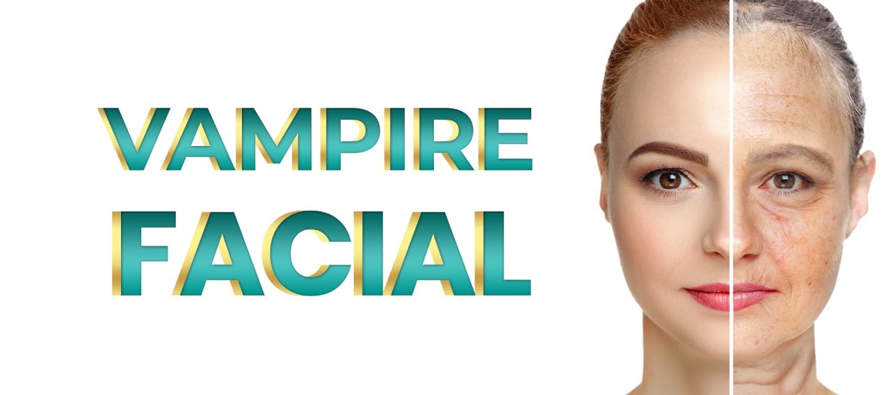 Vampire Facial Cost In Islamabad - Rehman Medical Center