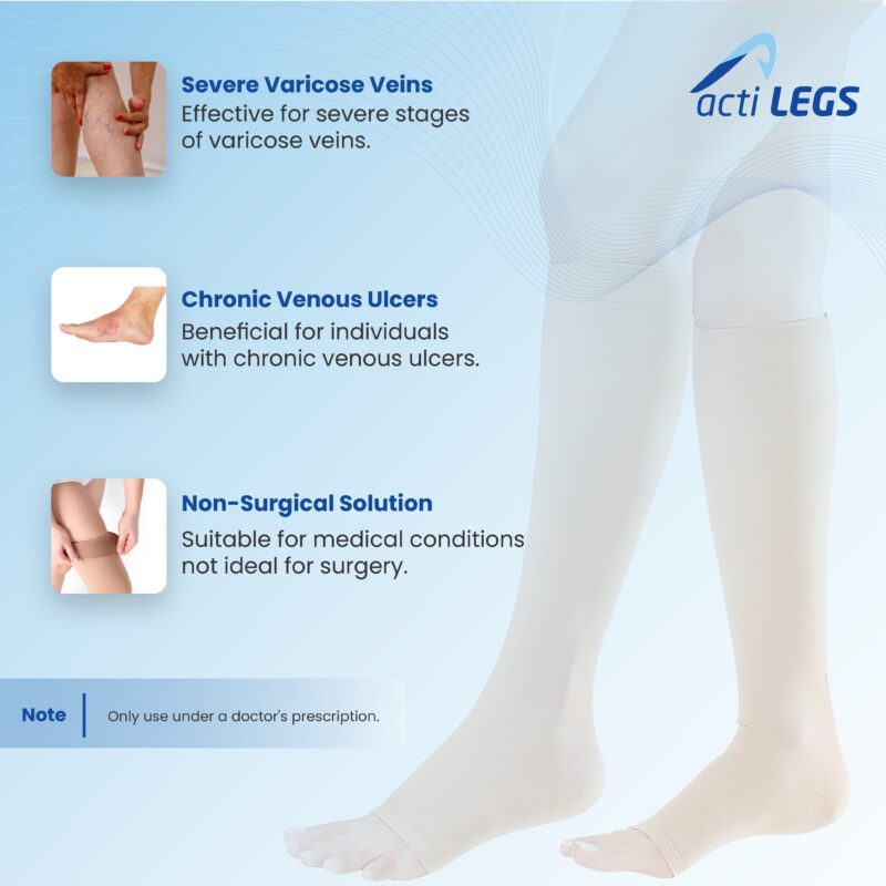 actiLEGS Medical Compression Stockings - Supportive Garments